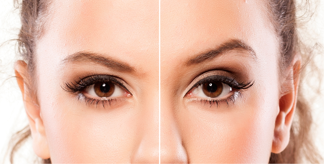 What Is a Eyebrow Lift? Types, Benefits, Risks - Plastic Surgery